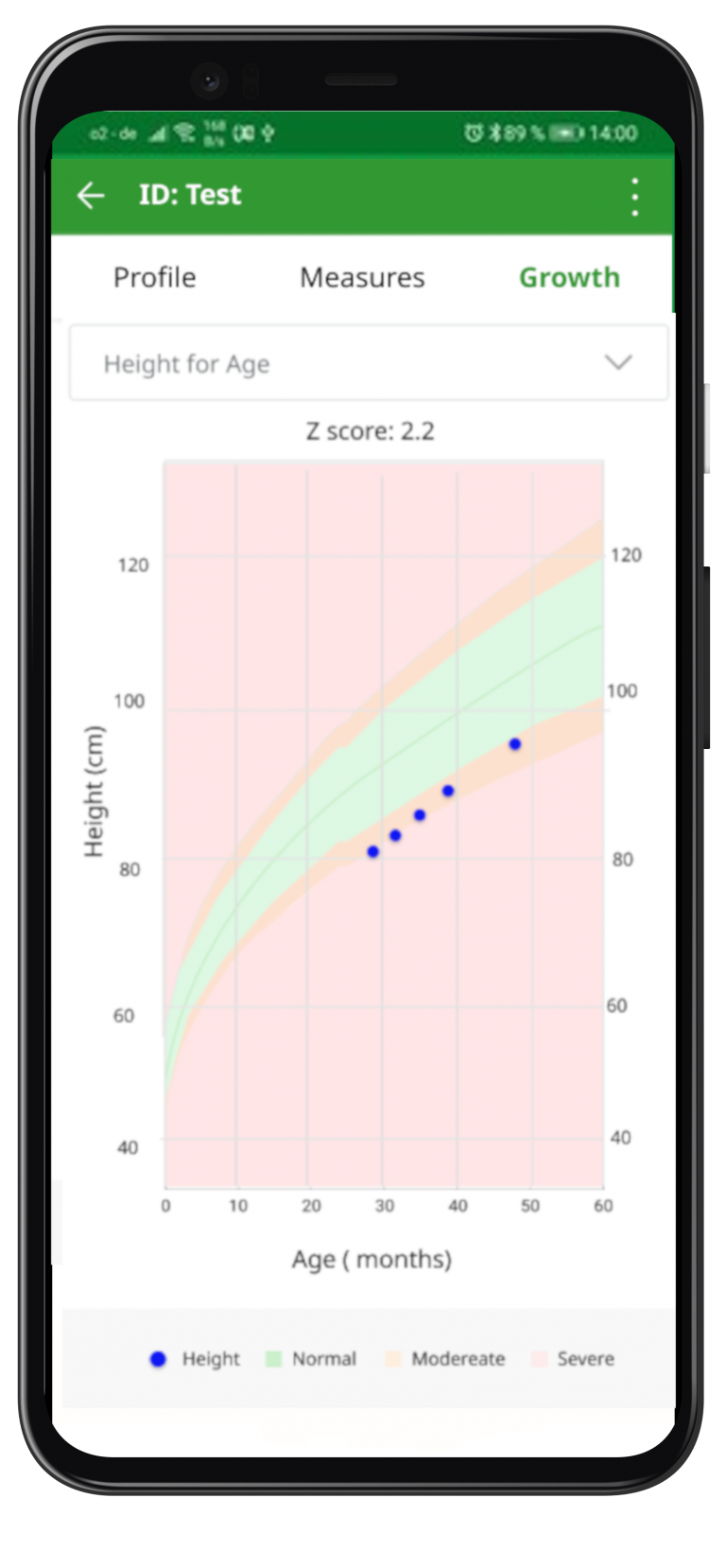 Child Growth Monitor - Child Growth Monitor