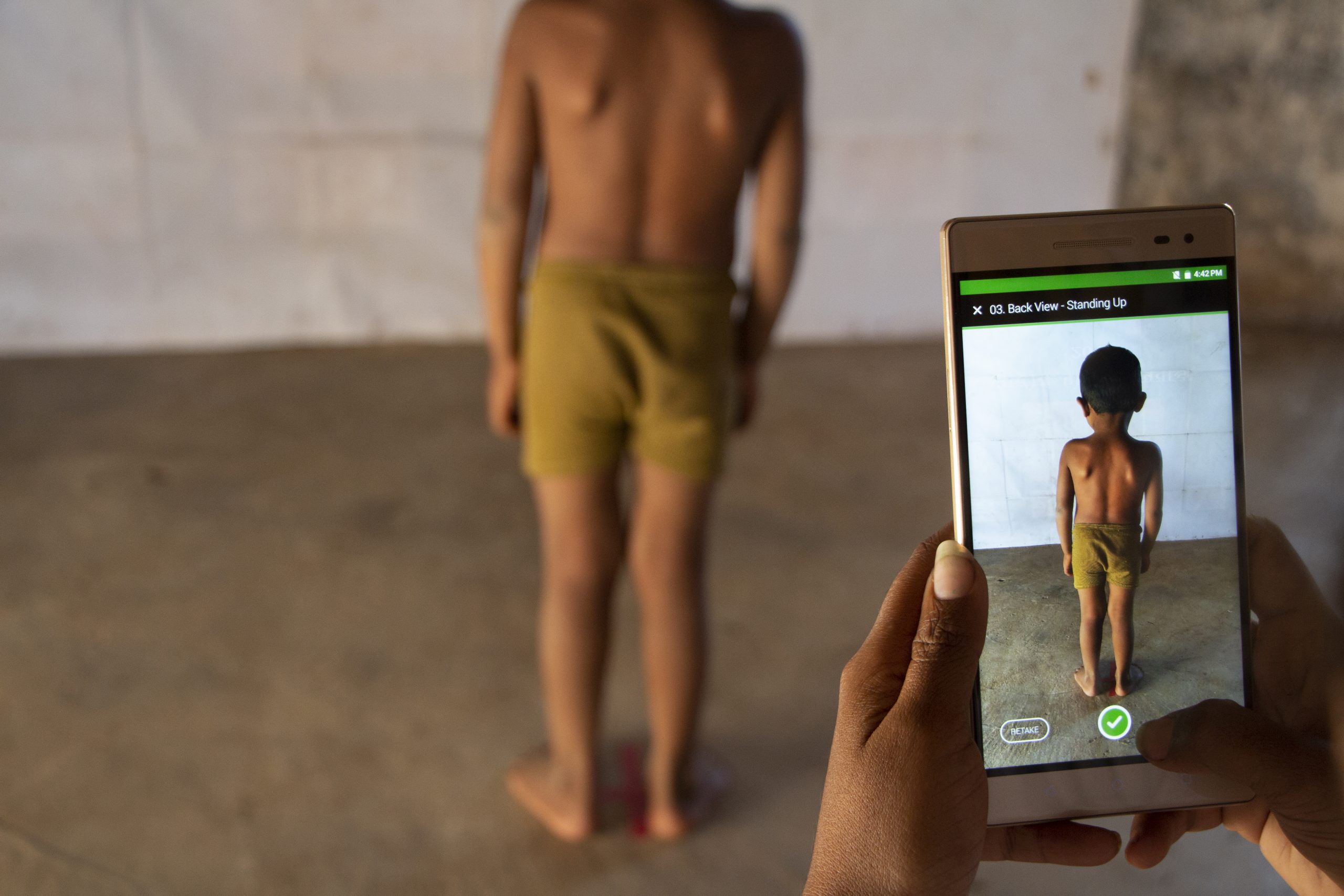 Product - Pilot study for stunting - Child Growth Monitor